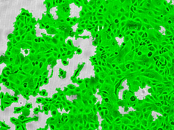 MOC2 Mouse Oral Squamous Cell Carcinoma (OSCC) Cell Line | SCC470